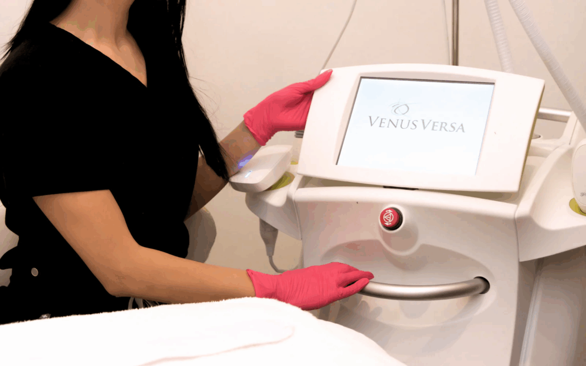IPL Venus Versa Guide | Dallas & Frisco | Renew Beauty